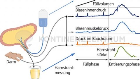 Urodynamik: Der Schlüssel zur richtigen Diagnose & Therapie der Reizblase